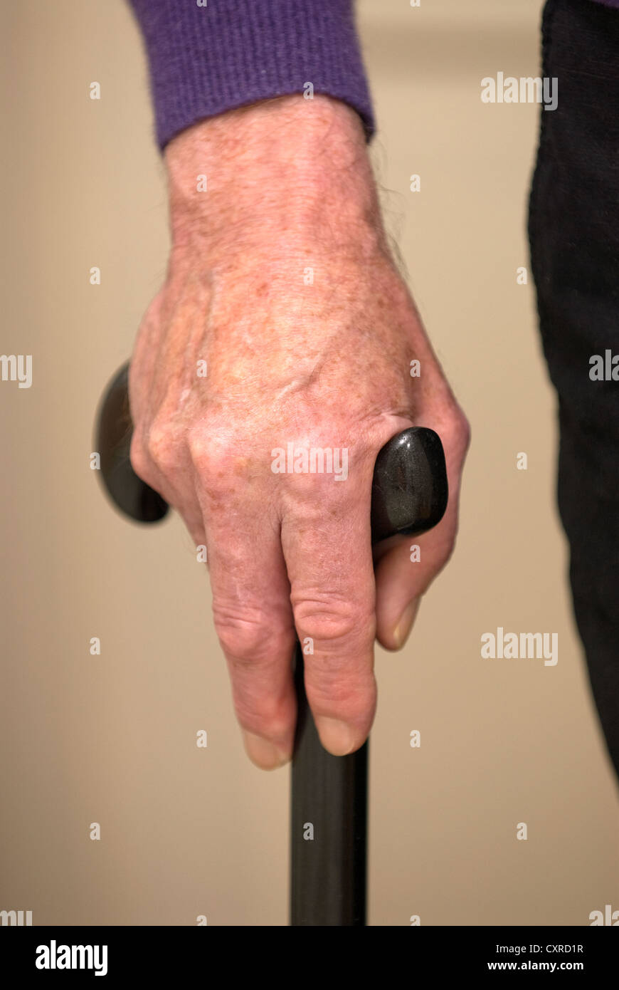 Man with physical disability holding walking stick, London, UK. Model ...