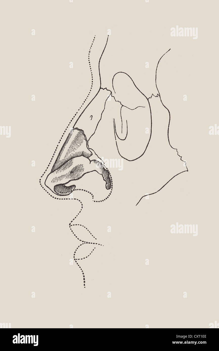 Anatomical illustrations human body hi-res stock photography and images ...