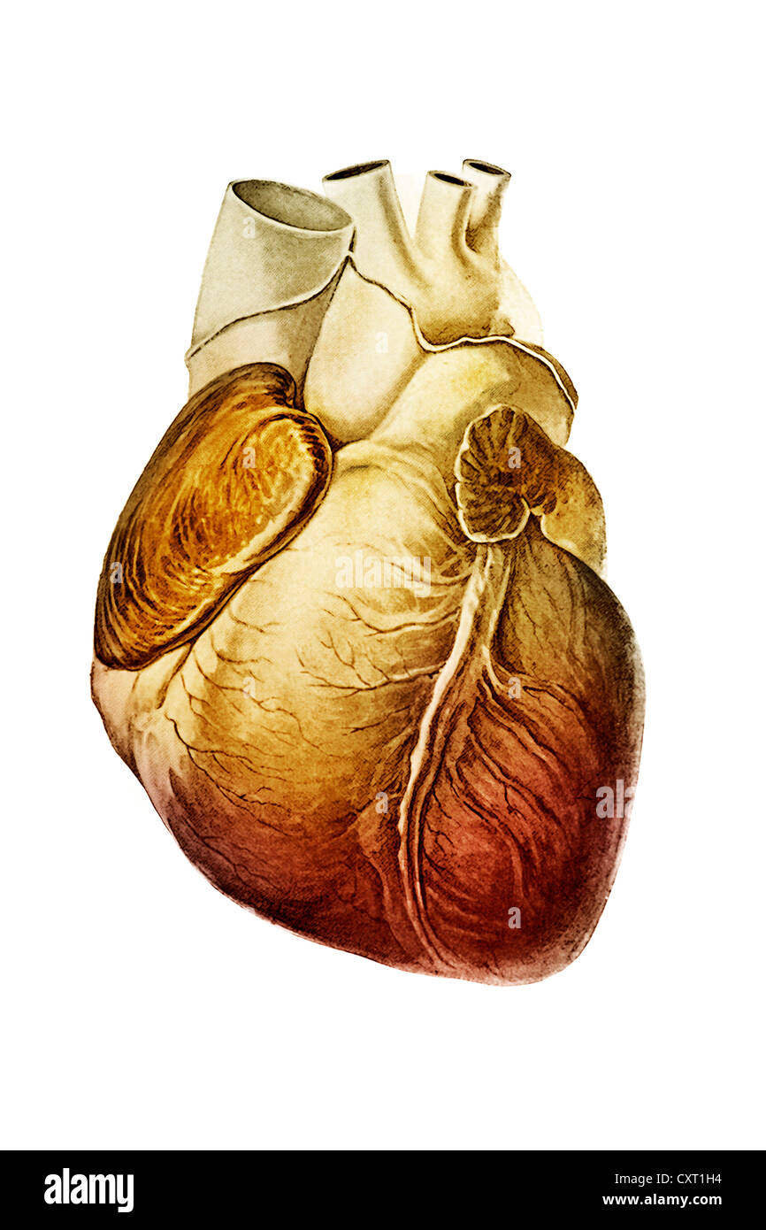 Human heart attack hi-res stock photography and images - Alamy