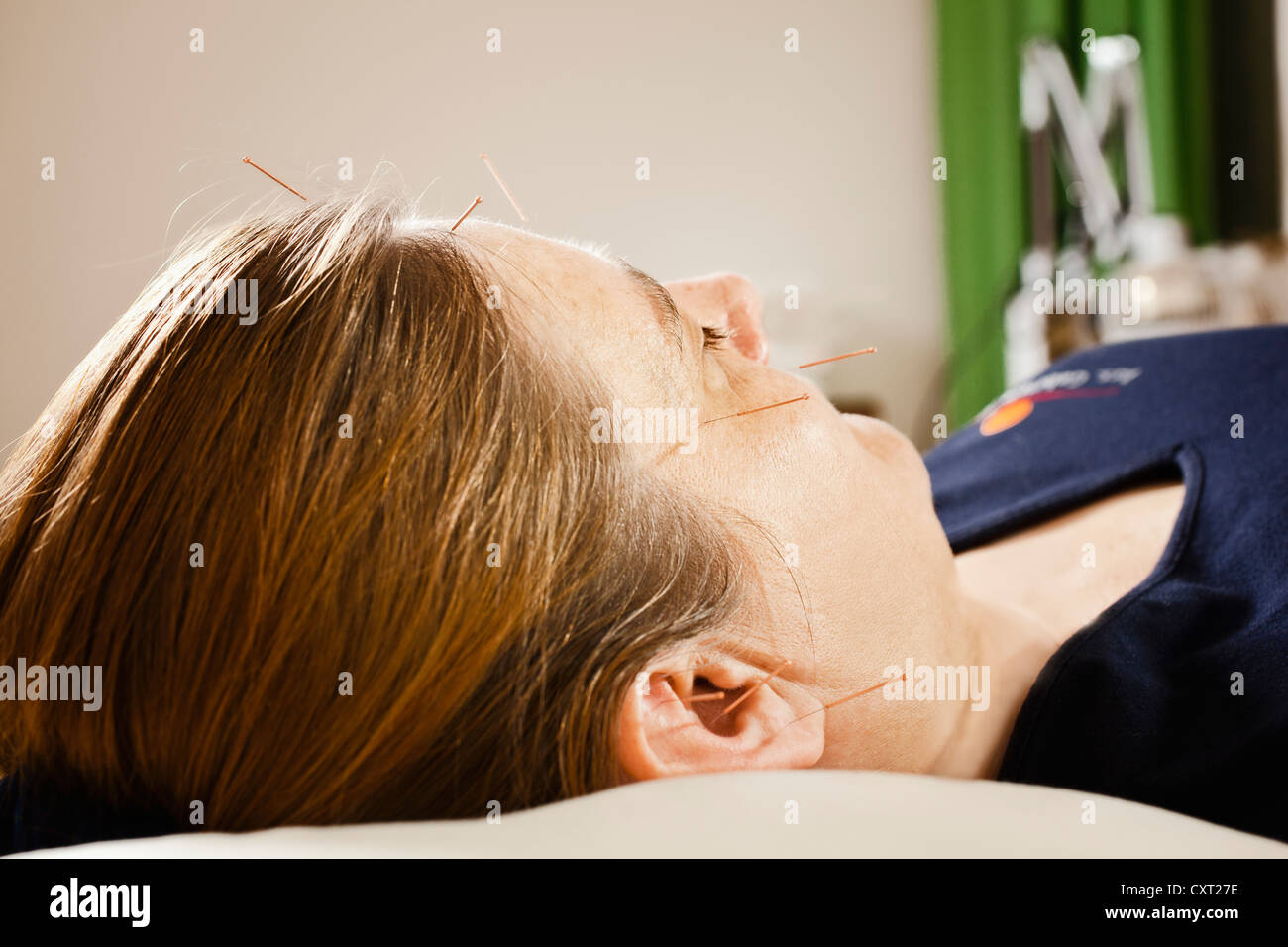 Woman getting acupuncture treatment, Traditional Chinese Medicine Stock ...