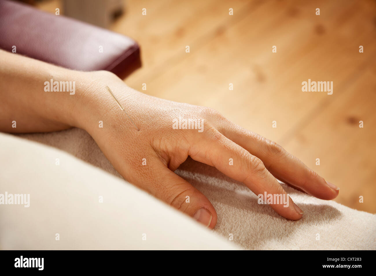 Hand, acupuncture treatment, Traditional Chinese Medicine Stock Photo ...