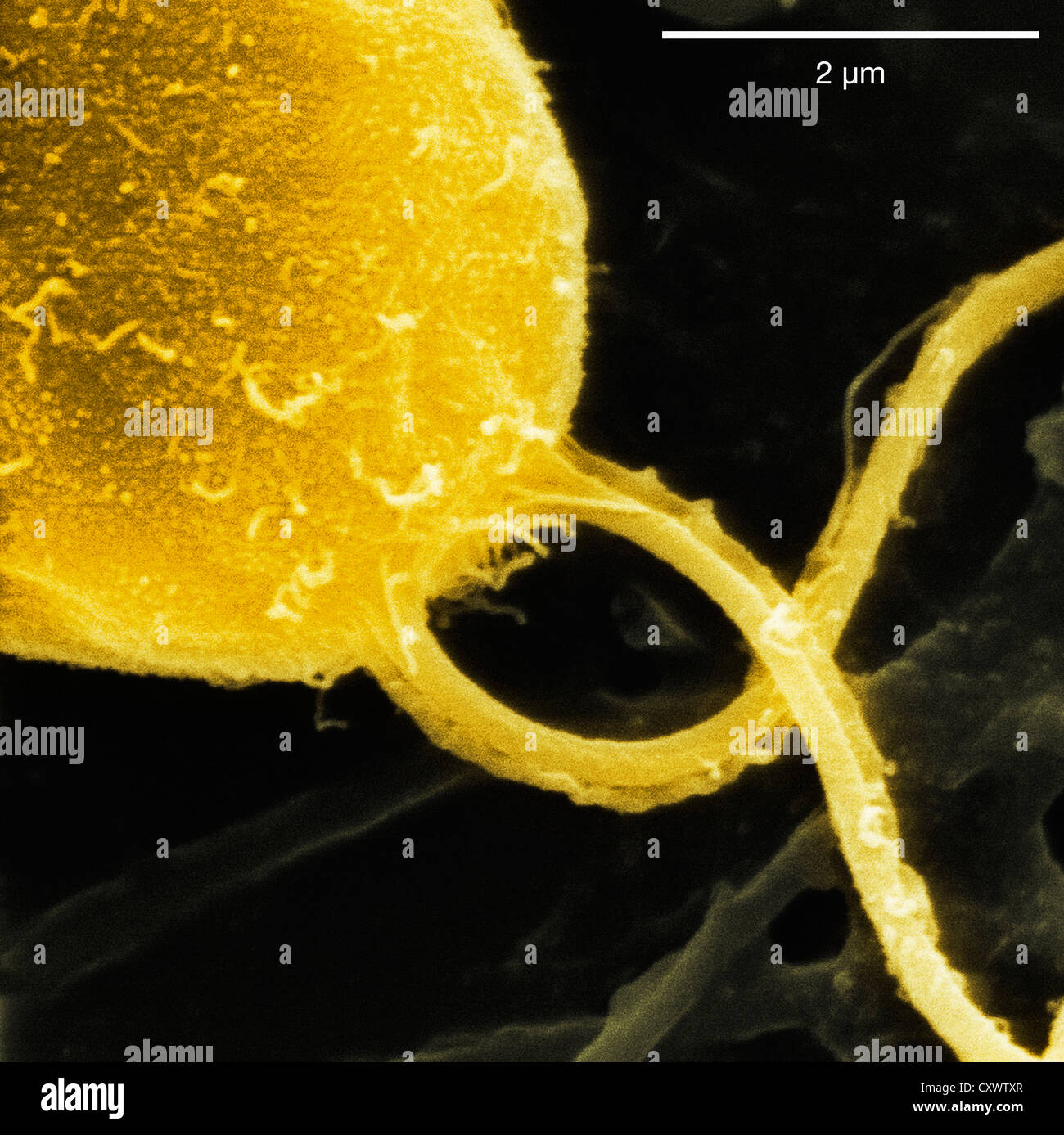 Scanning electron micrograph of algae Stock Photo - Alamy