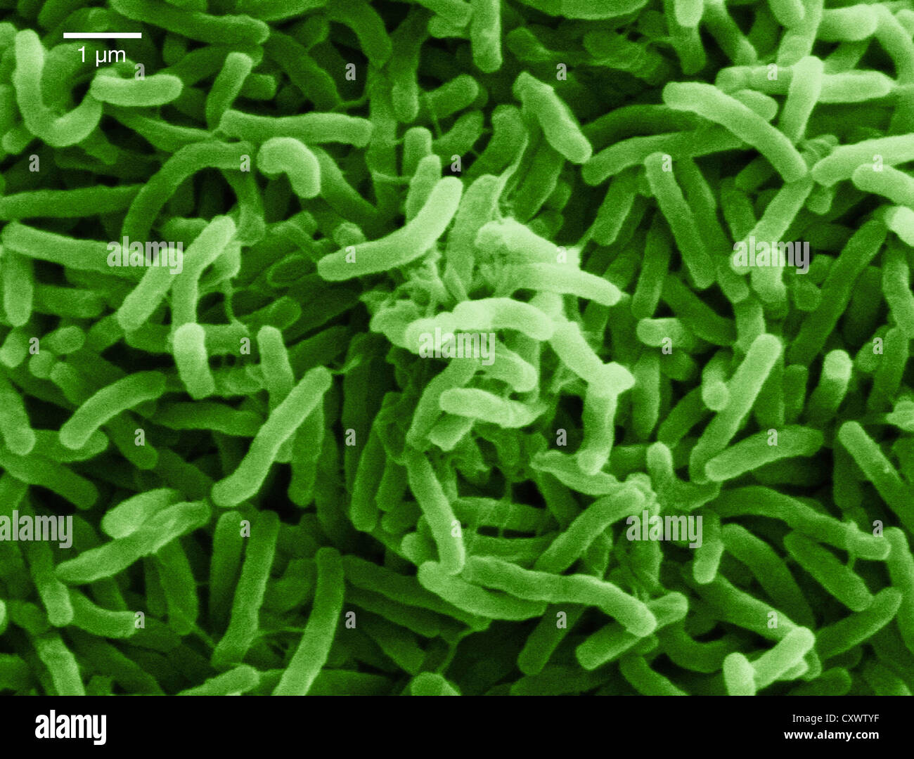 Scanning electron micrograph of Cholera bacteria Stock Photo - Alamy