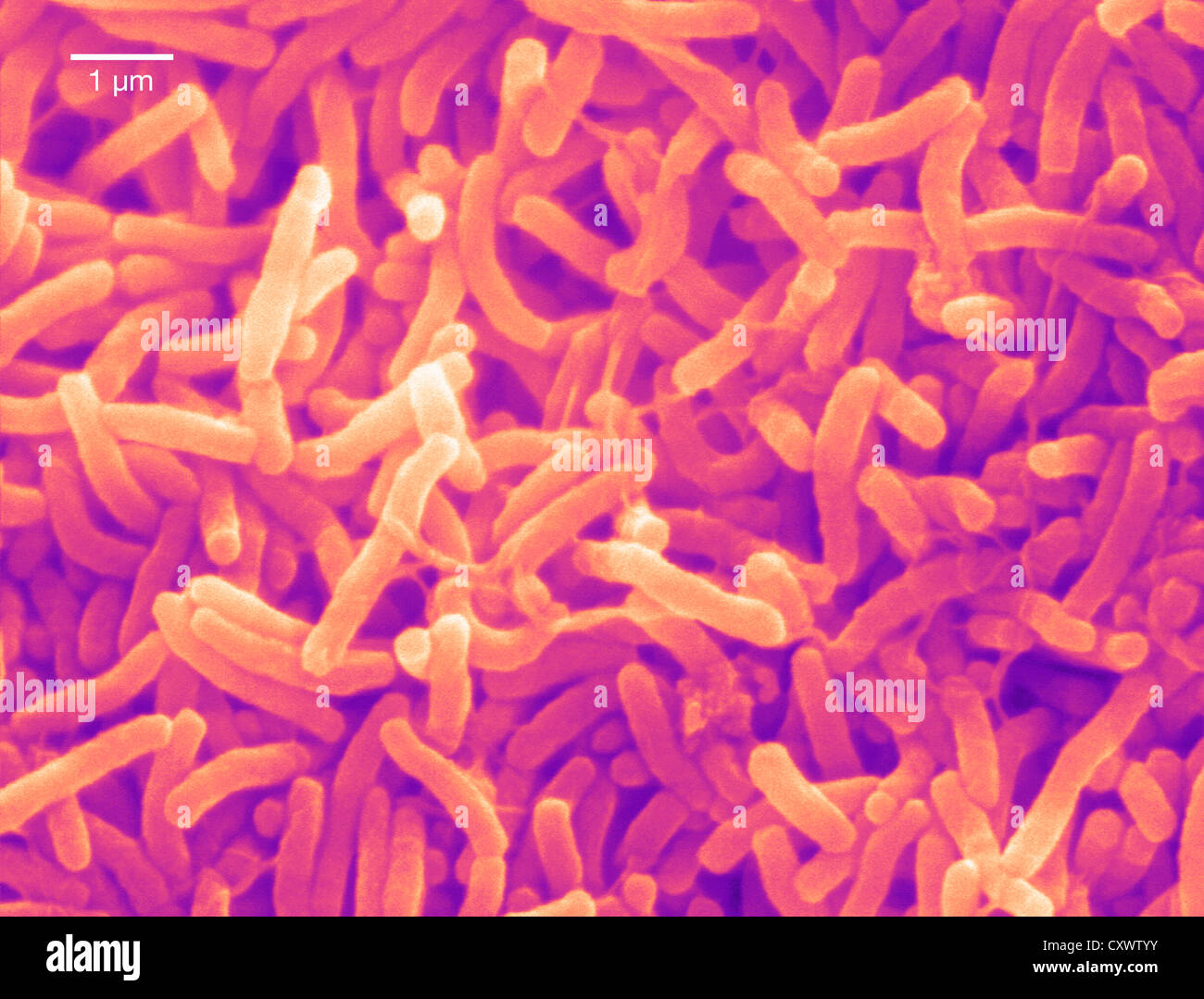 Vibrio cholera sem hi-res stock photography and images - Alamy