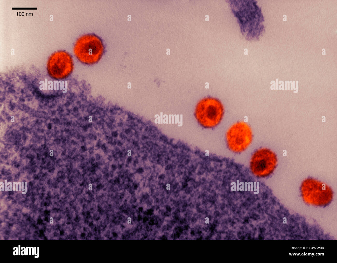 Transmission electron micrograph of HIV Stock Photo - Alamy