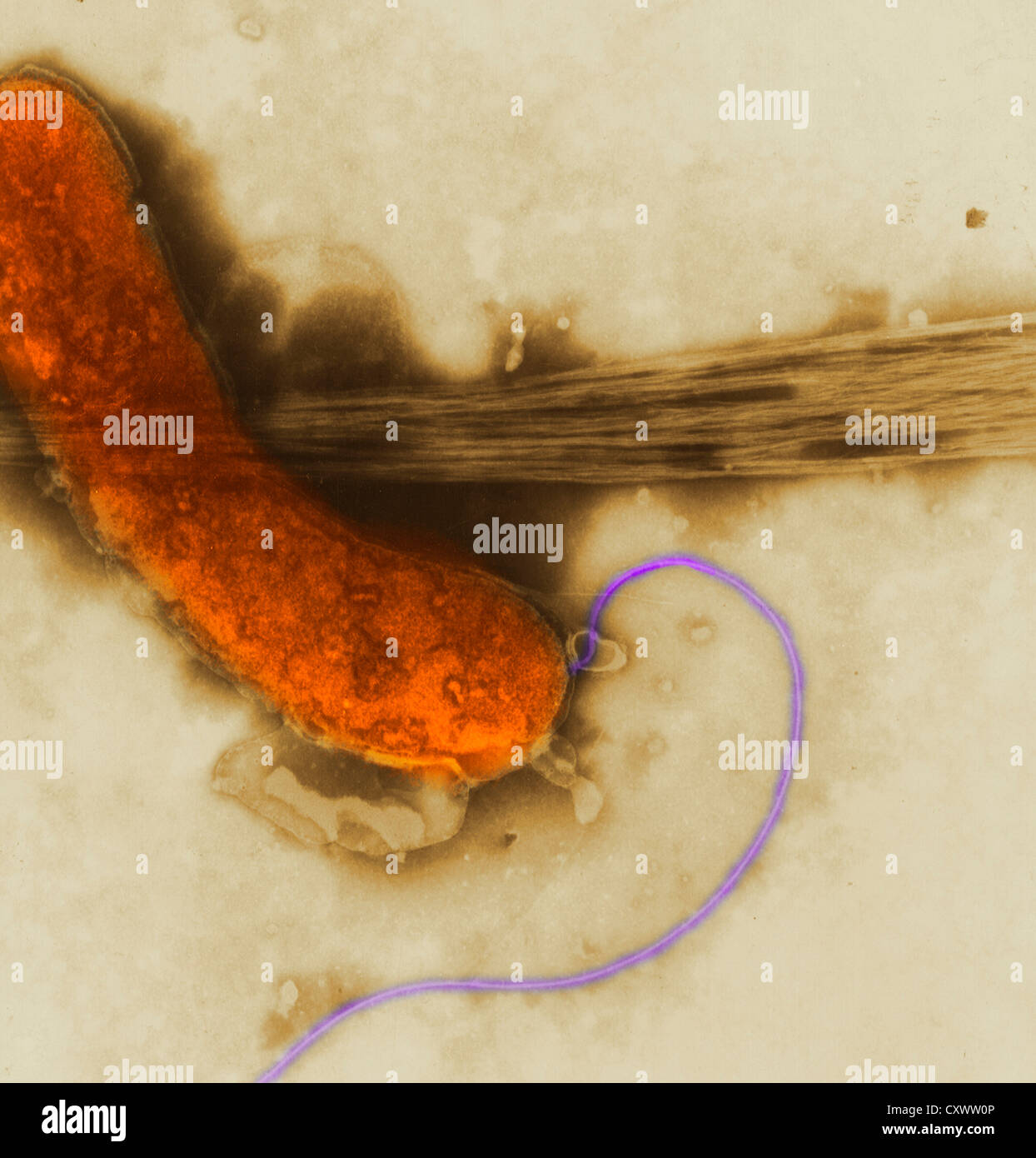 Scanning electron micrograph of Cholera bacteria Stock Photo - Alamy