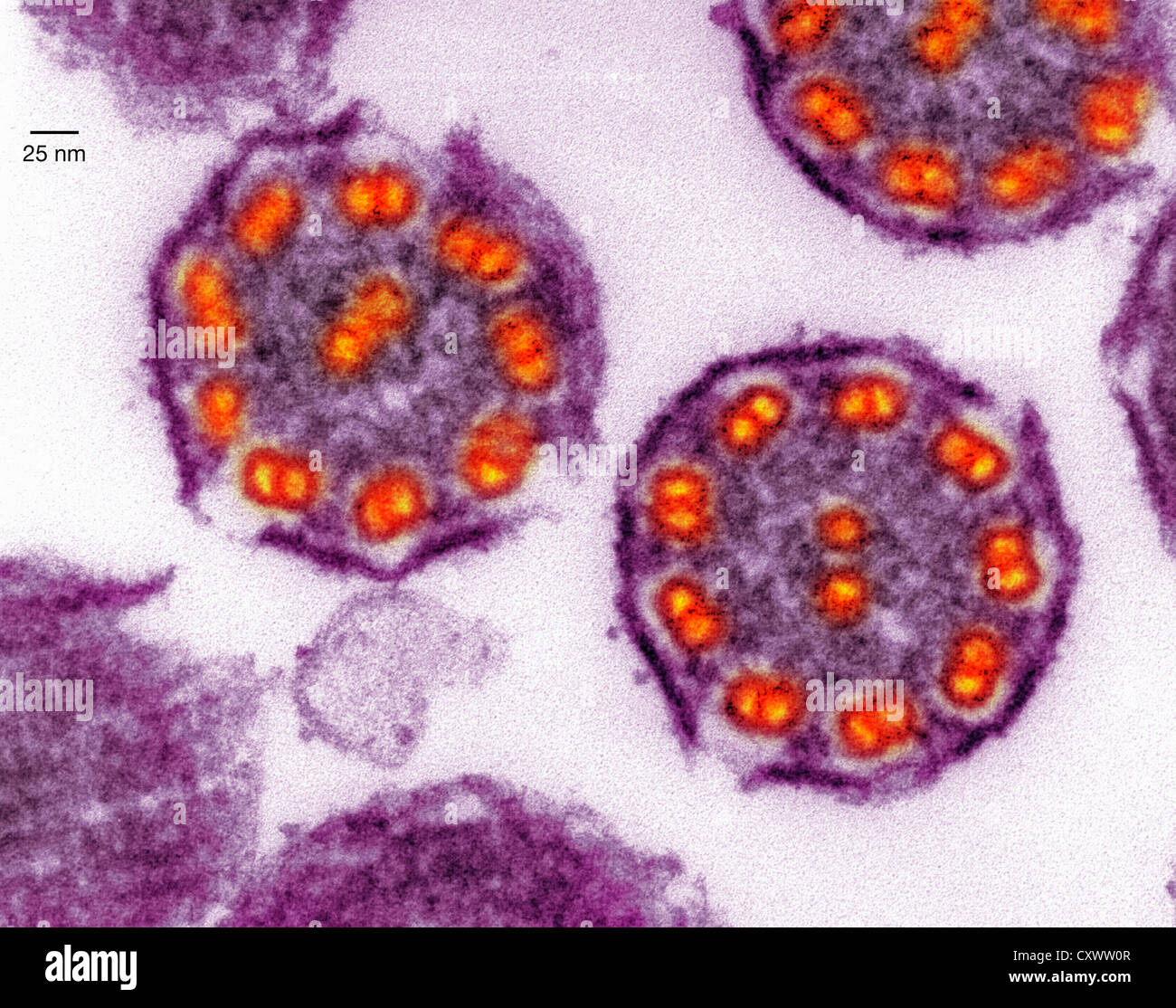 Transmission electron micrograph hi-res stock photography and images ...