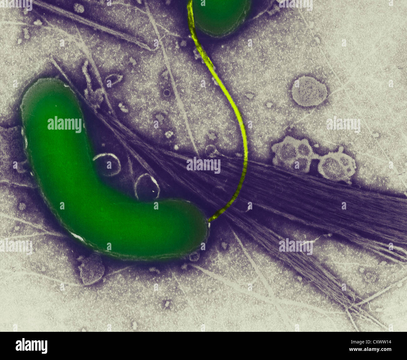 Scanning electron micrograph of Cholera bacteria Stock Photo - Alamy