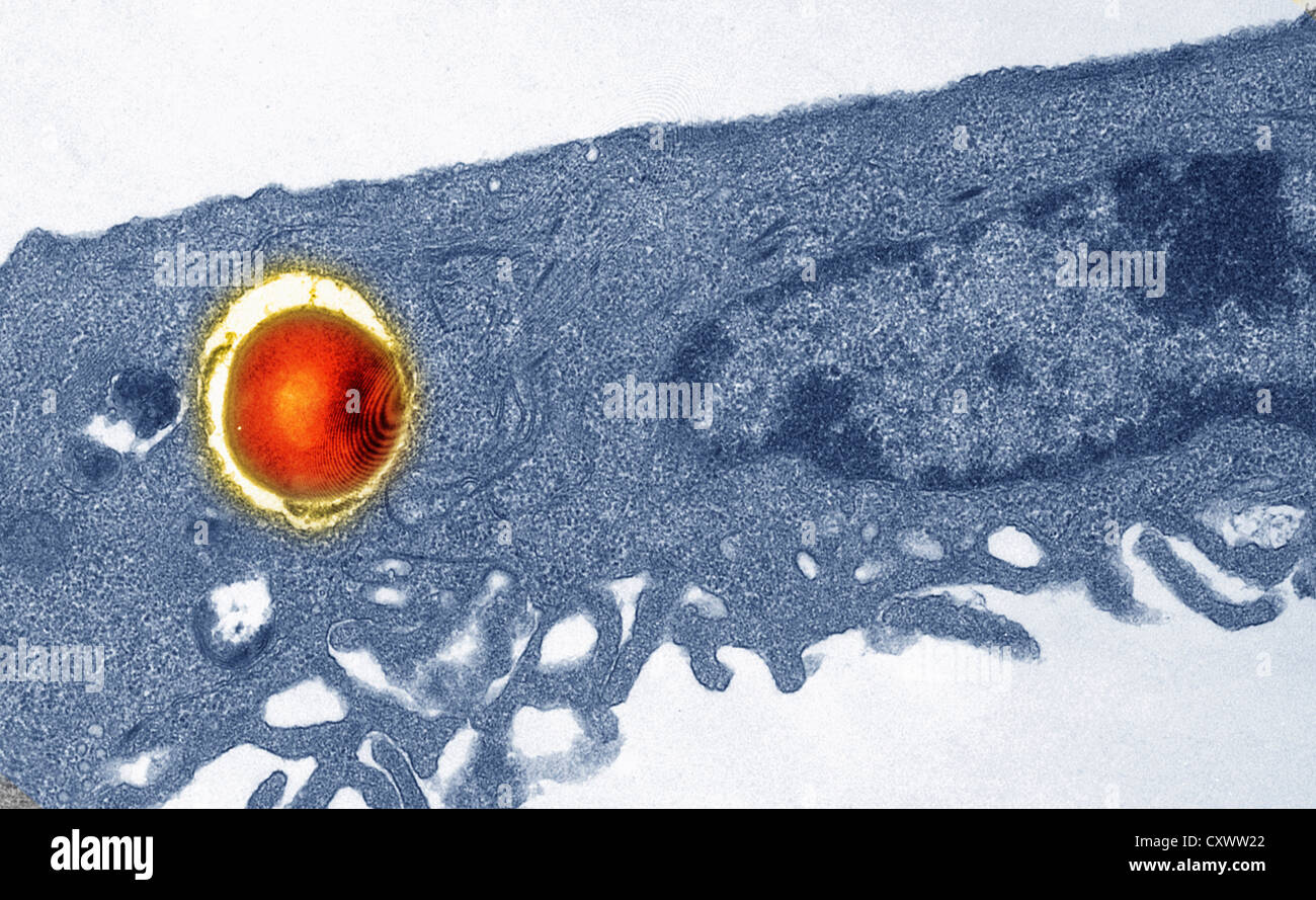 Transmission electron micrograph of Staphylococcus Stock Photo - Alamy