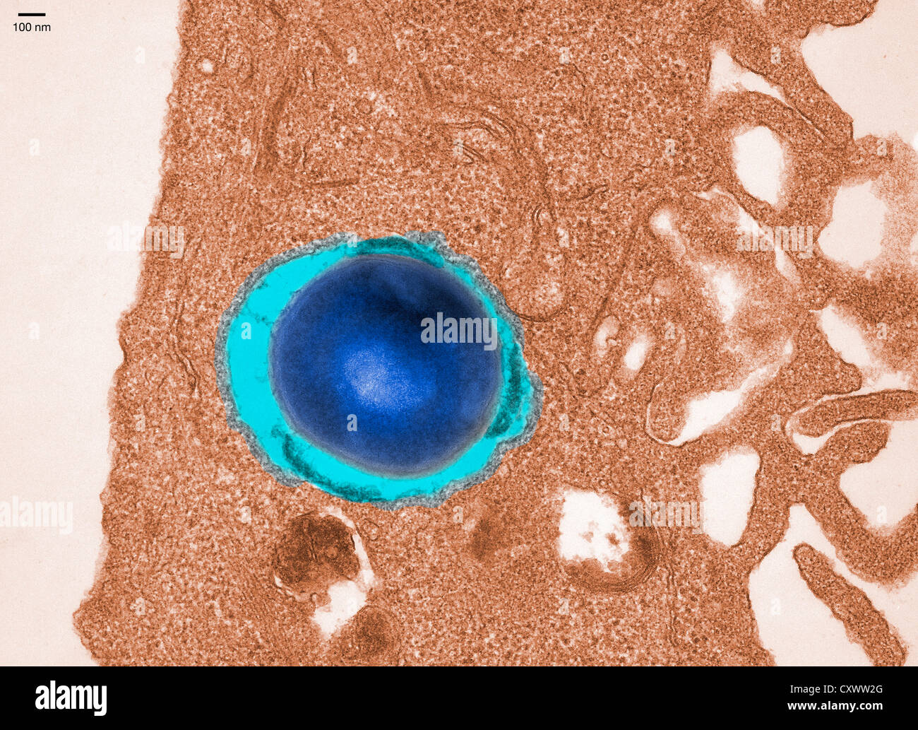 Transmission electron micrograph of Staphylococcus Stock Photo - Alamy