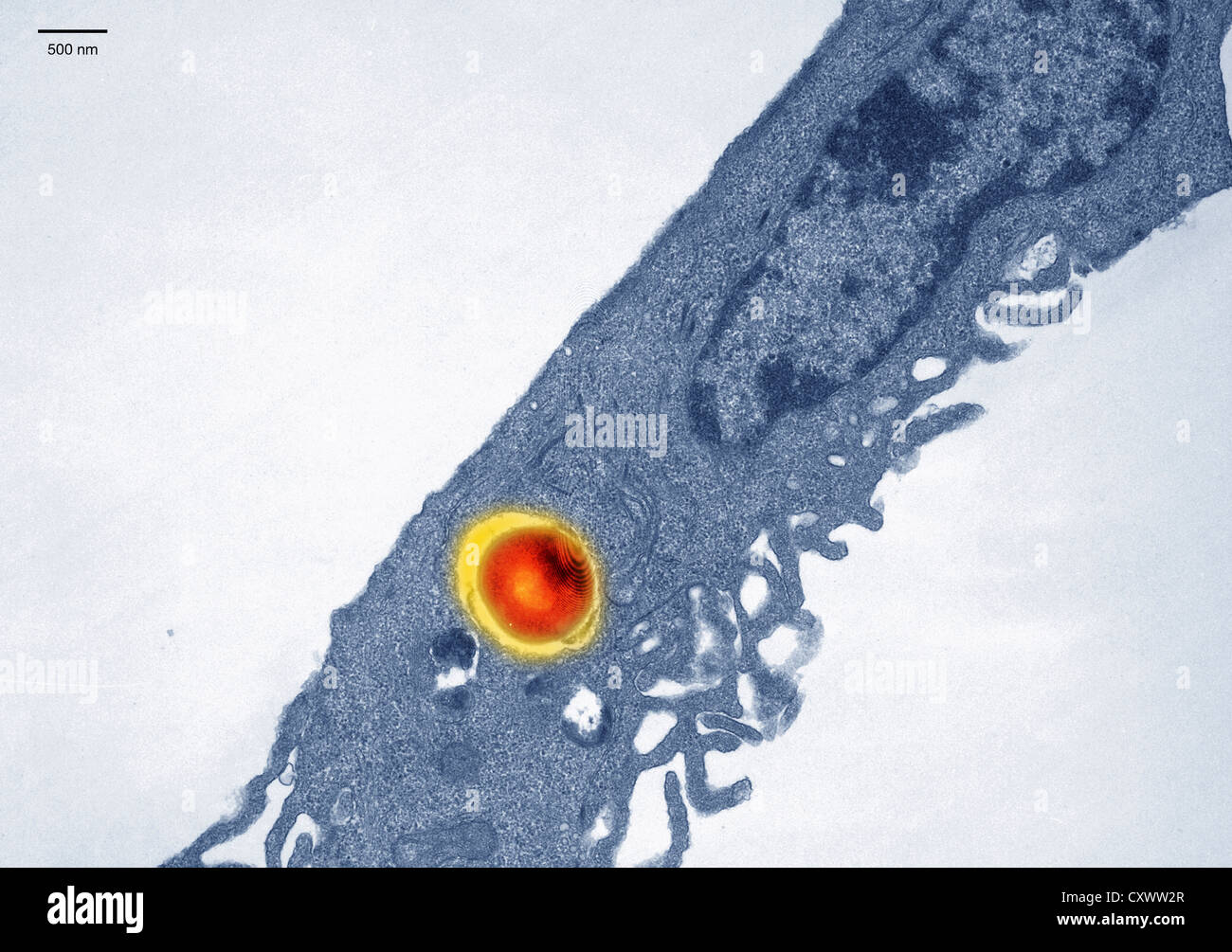 Transmission electron micrograph of Staphylococcus Stock Photo - Alamy