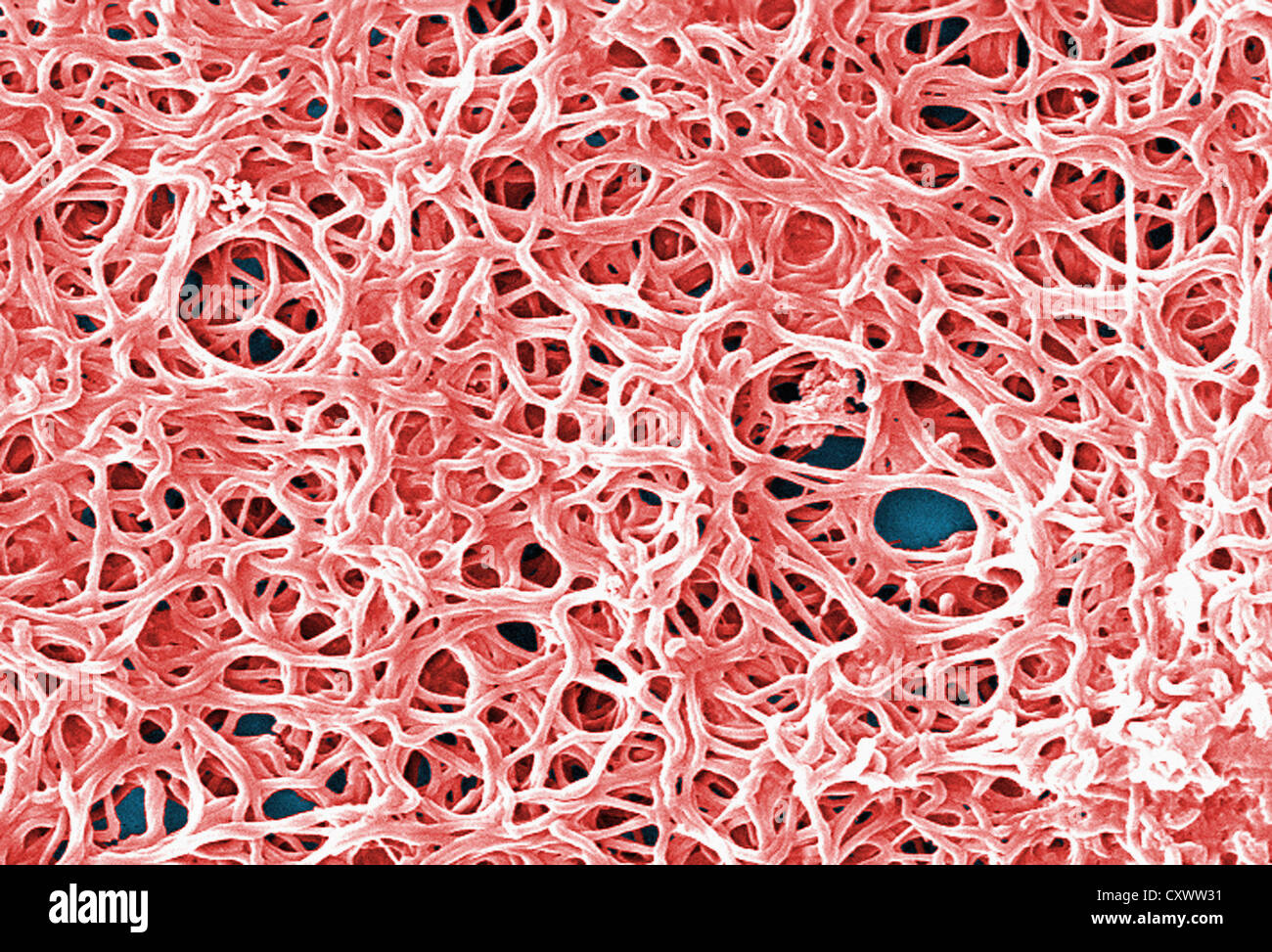 Borrelia Burgdorferi Bacteria Microscope