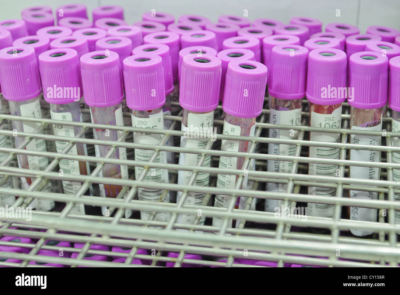 ฺBlood tubes in detail Lab Medical Pharmaceutical Research Stock Photo ...