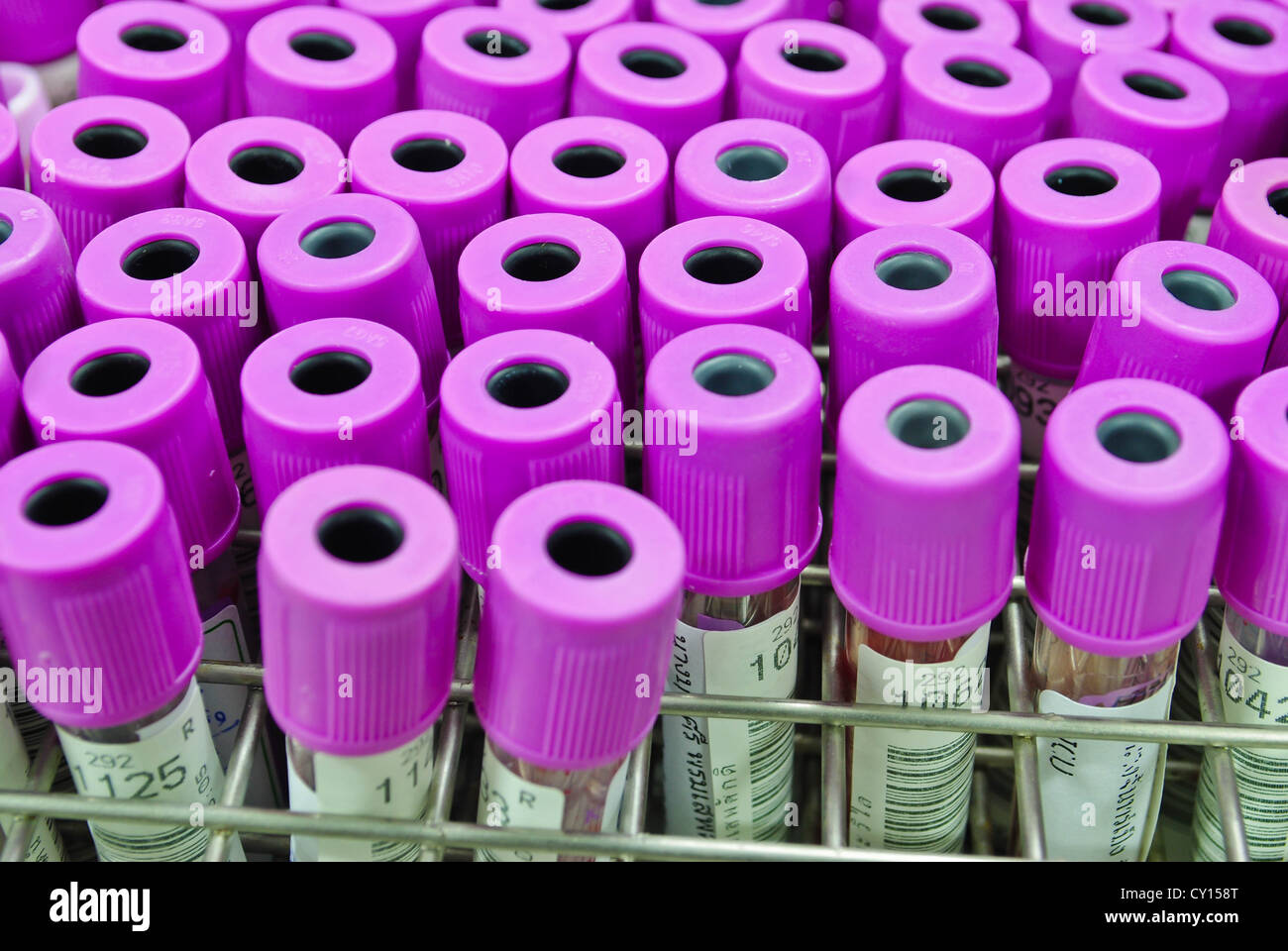 a view blood tubes in detail Stock Photo - Alamy