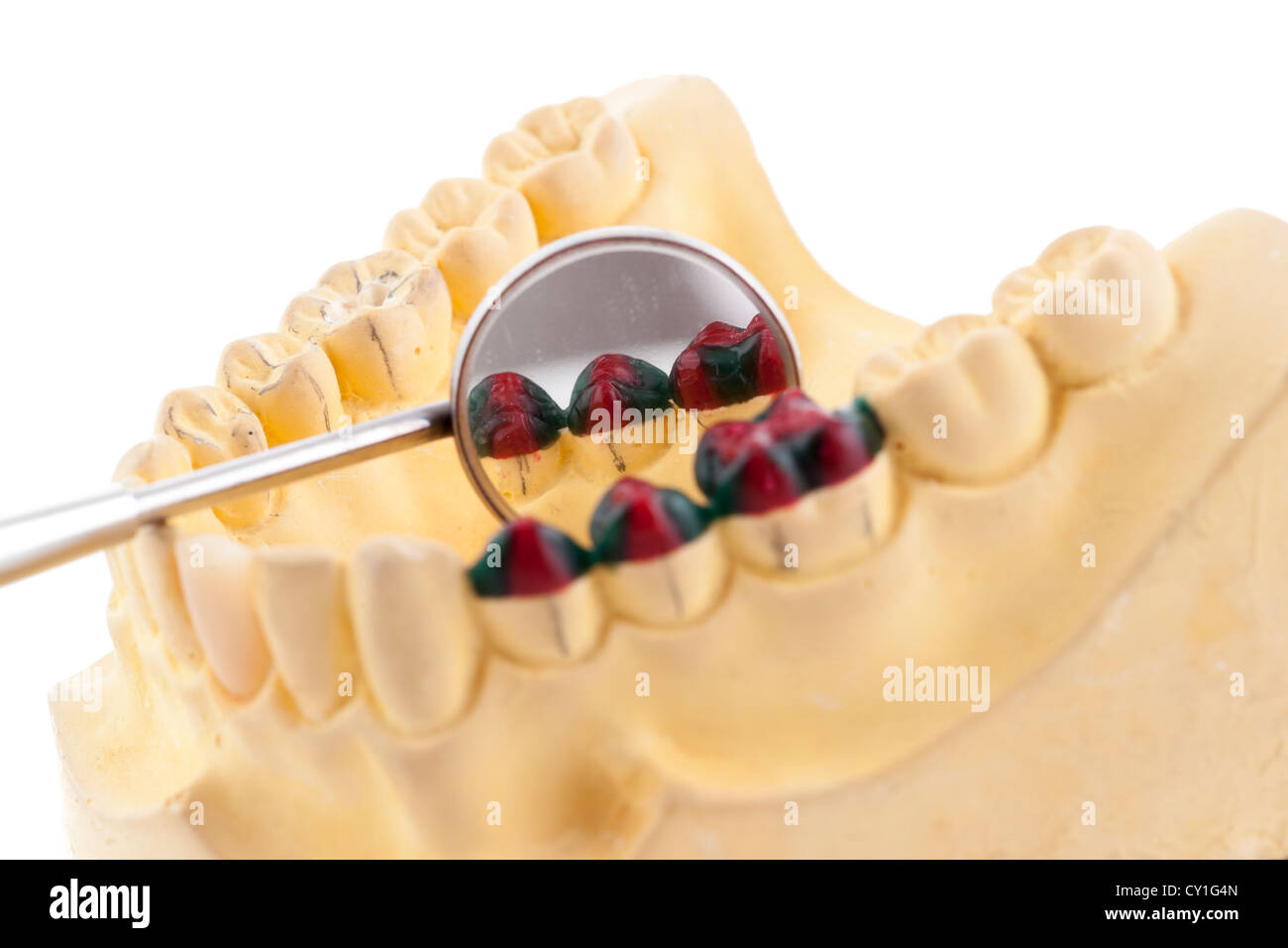 Denture cast model and dental tools Stock Photo - Alamy