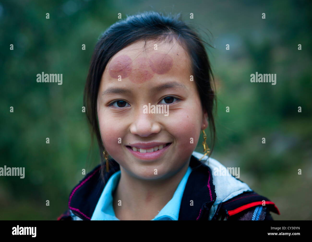 Black Hmong Girl With Tattoos On The Forehead, Sapa, Vietnam Stock ...