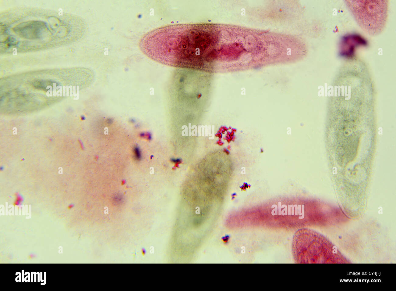 Spirostomum Under Microscope 400x