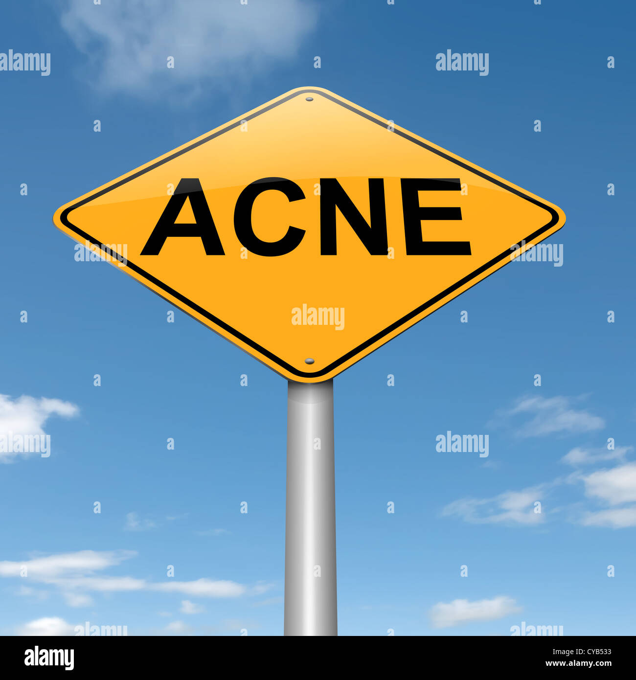 Spotty acne youth skin hi-res stock photography and images - Alamy
