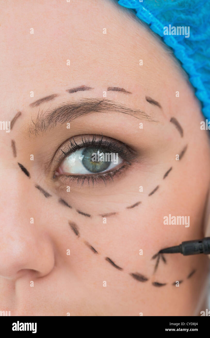 Plastic surgery doctor writing on hi-res stock photography and images ...