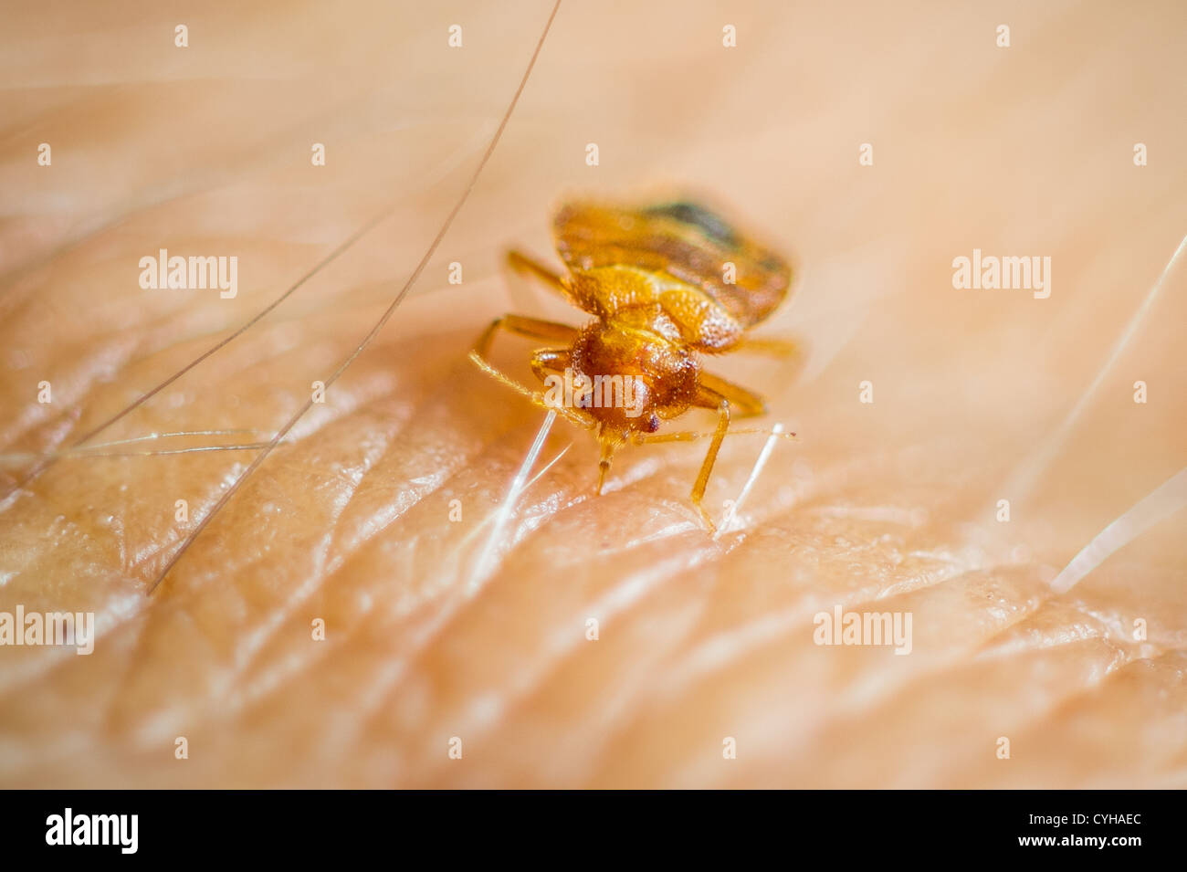 Bed bug feeding on human skin Stock Photo - Alamy