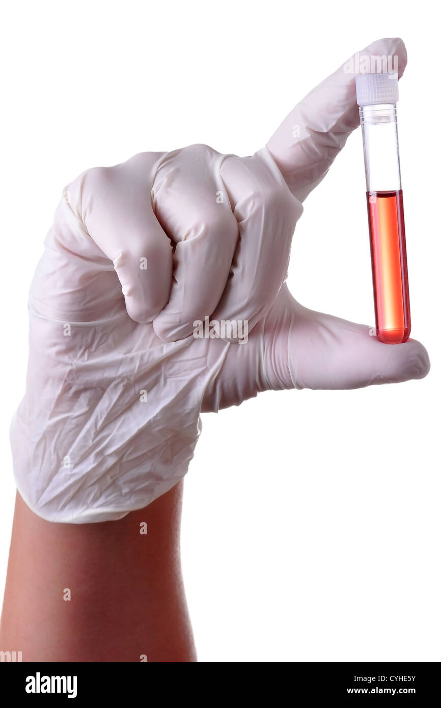 Blood test analysis finger hi-res stock photography and images - Alamy
