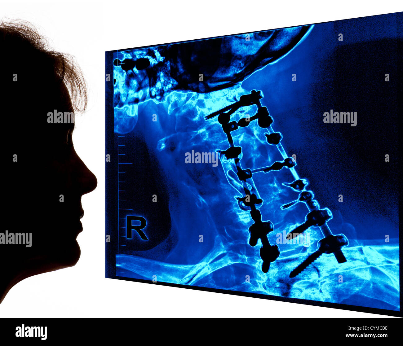 woman doctor checking spinal X-ray Stock Photo - Alamy