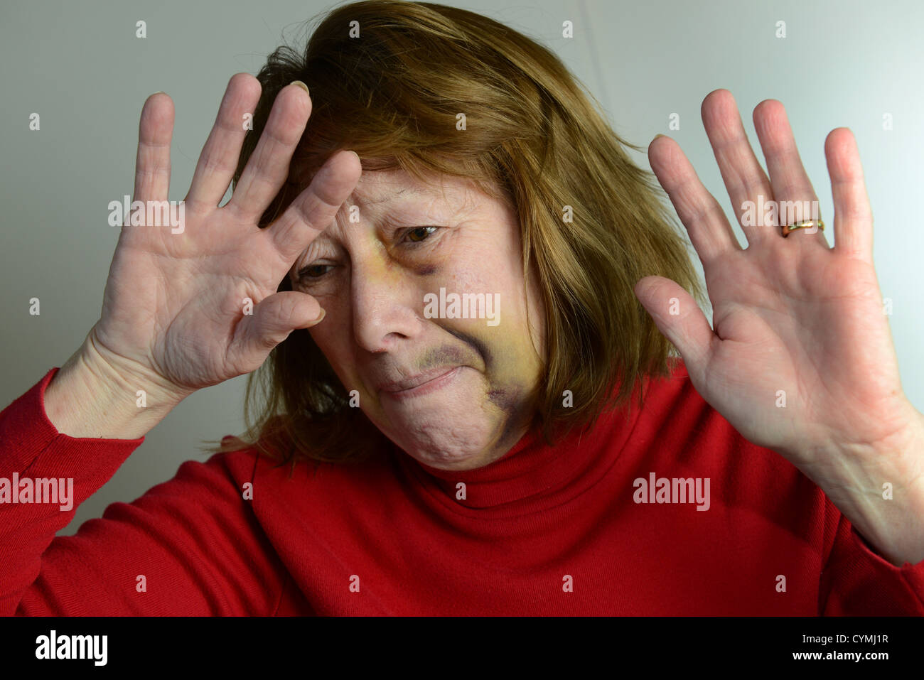 Face scar woman hi-res stock photography and images - Alamy