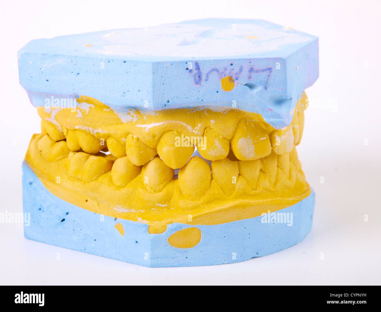 Toothless upper jaw hi-res stock photography and images - Alamy