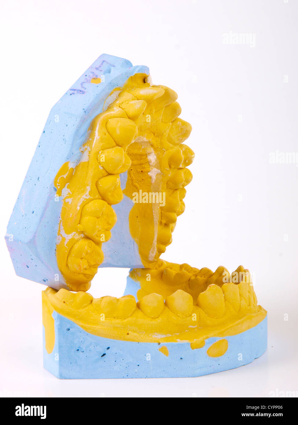 teeth plaster cast Stock Photo - Alamy