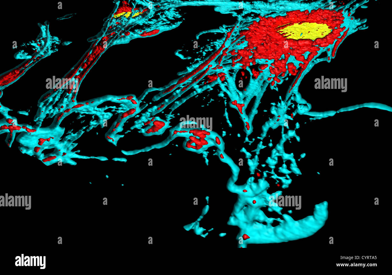 Microfilaments micrograph hi-res stock photography and images - Alamy