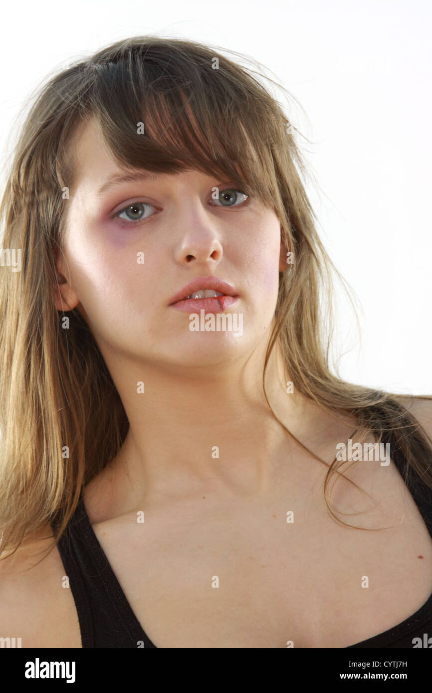 The victim an assaulted girl hi-res stock photography and images - Alamy