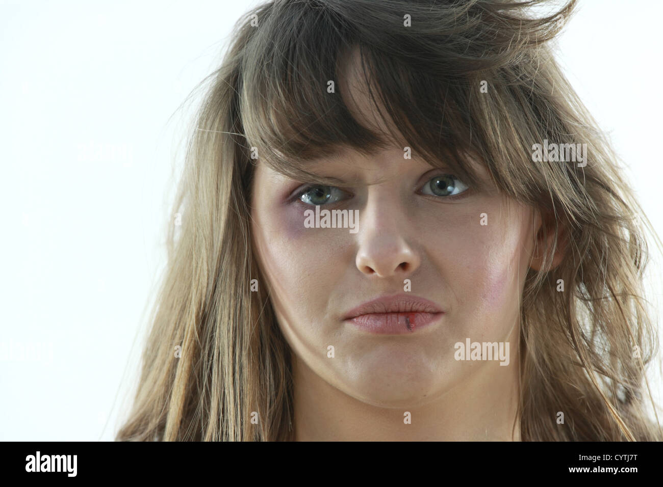 Abused girl over white background Stock Photo - Alamy