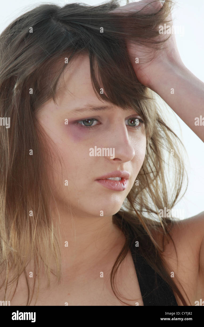 The victim an assaulted girl hi-res stock photography and images - Alamy