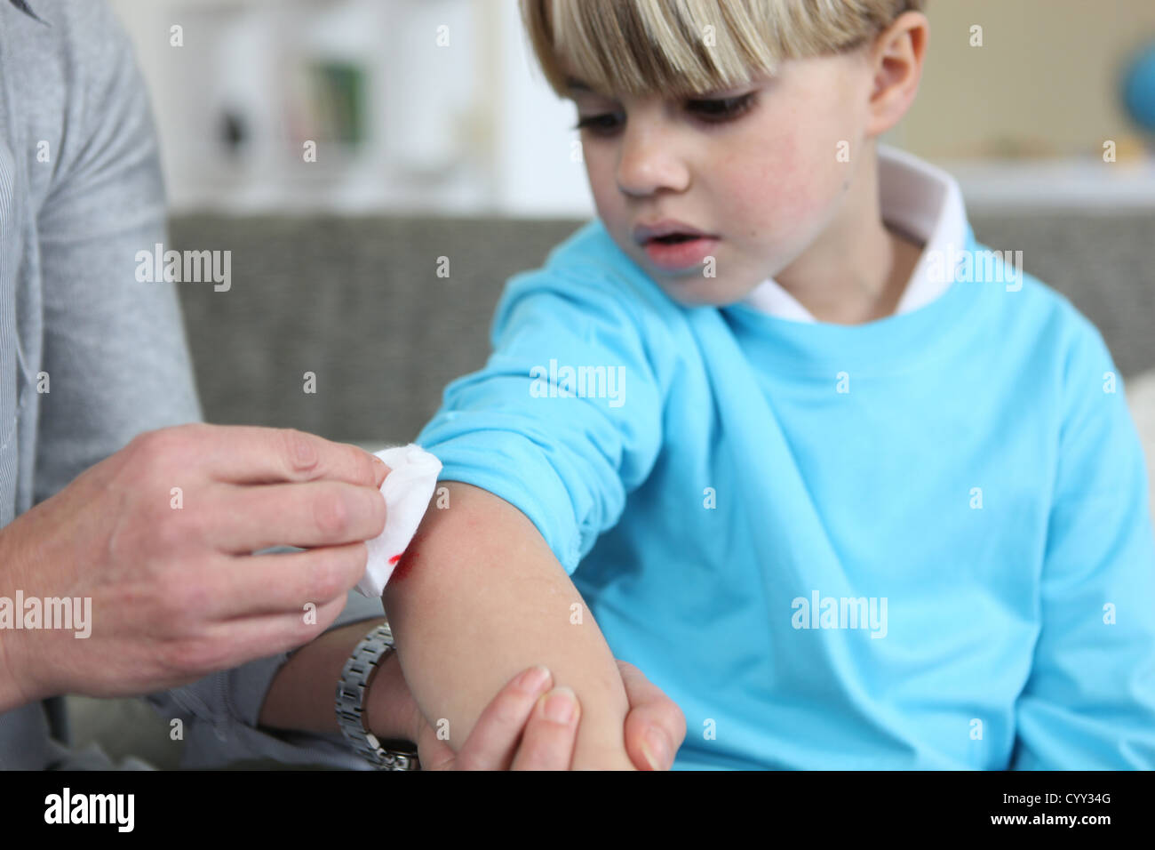 Grazed elbow hi-res stock photography and images - Alamy