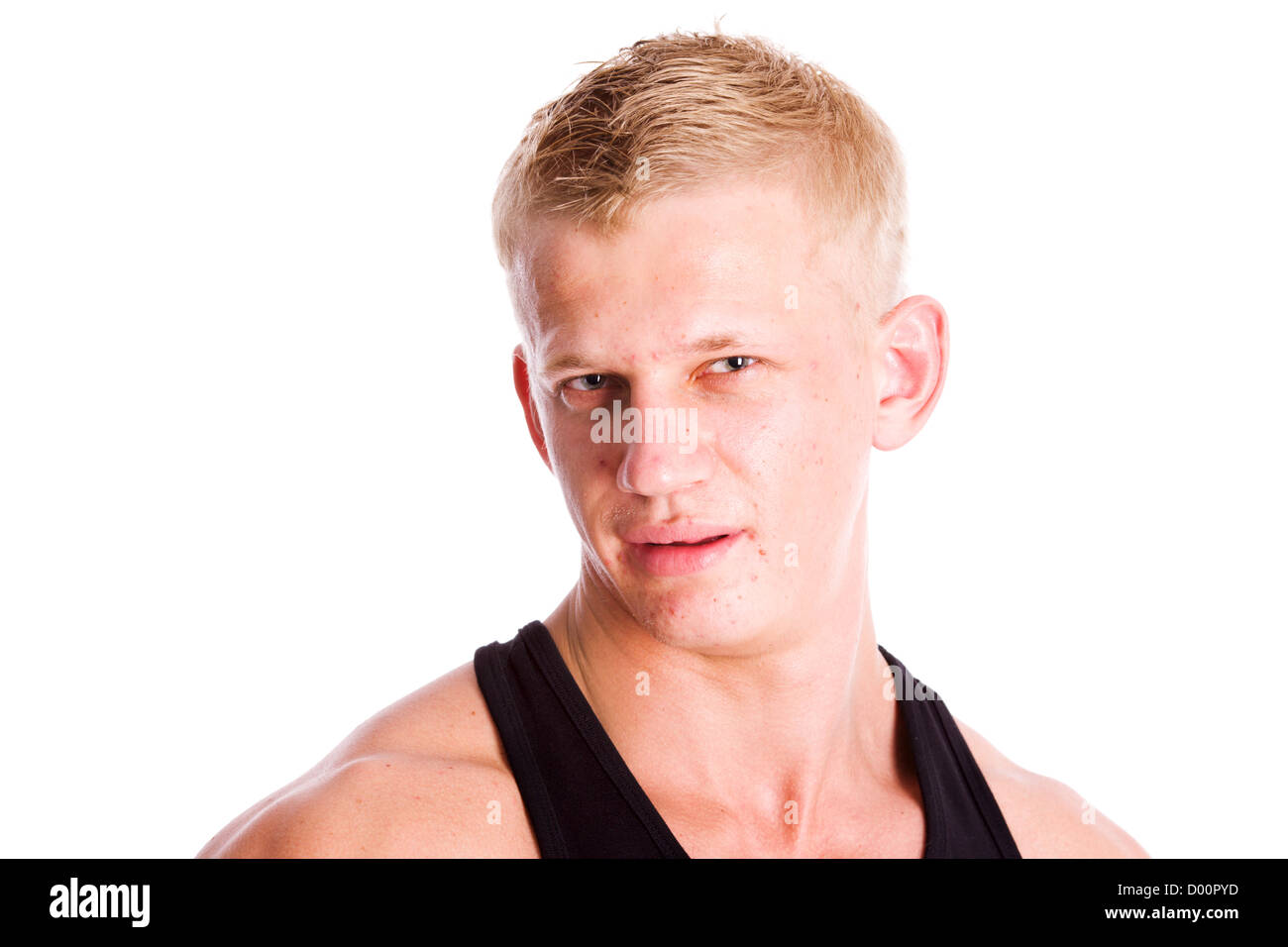 Young man with acne problem skin isolated on white Stock Photo - Alamy