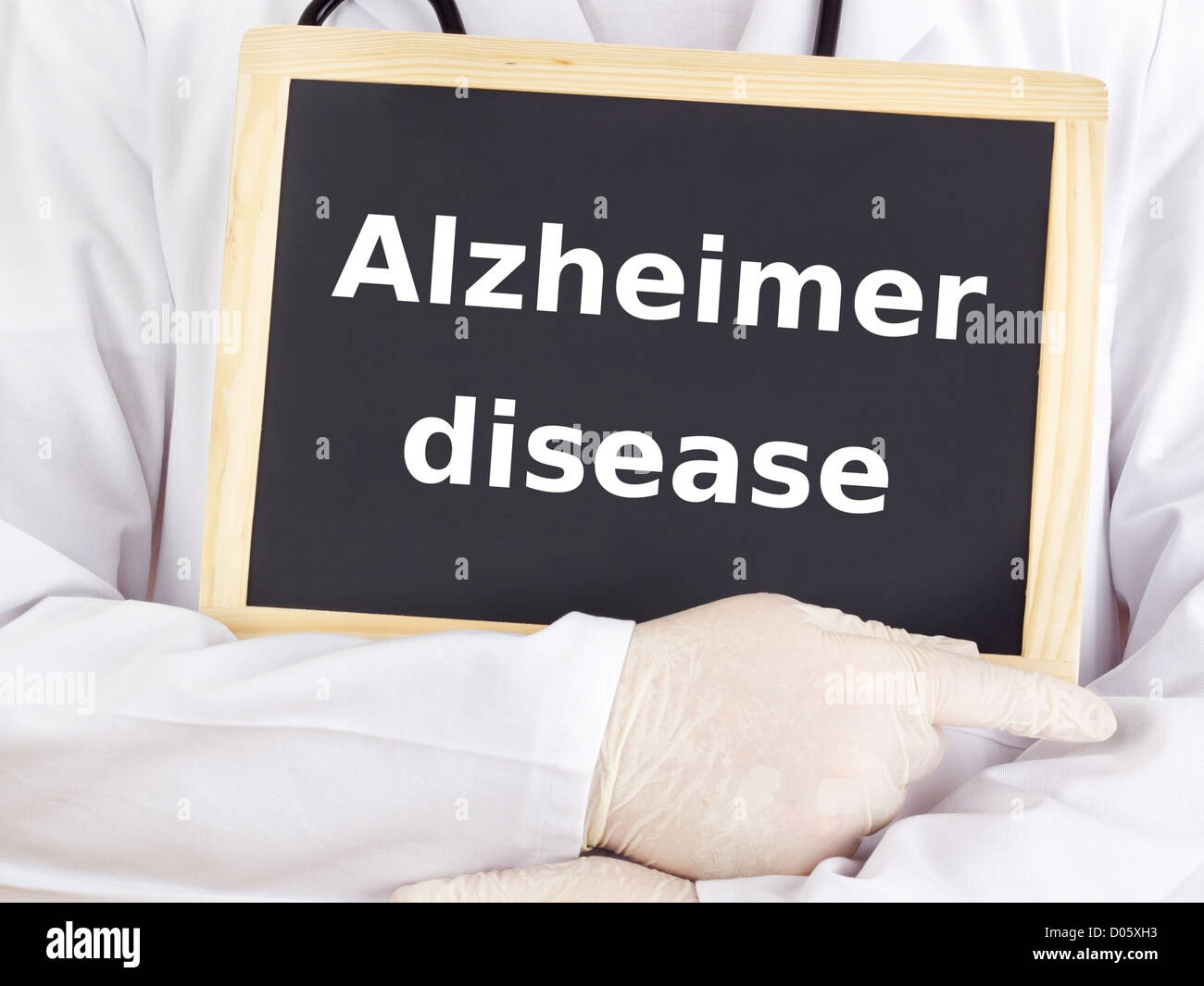 Doctor shows information: alzheimer disease Stock Photo - Alamy