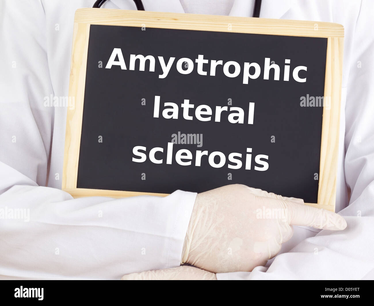 Doctor shows information: amyotrophic lateral sclerosis Stock Photo - Alamy