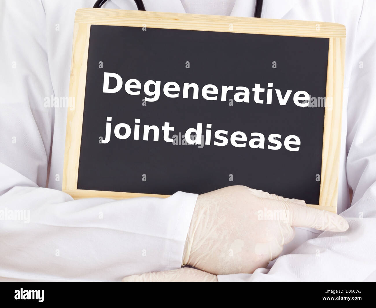 Degenerative joint disease hi-res stock photography and images - Alamy