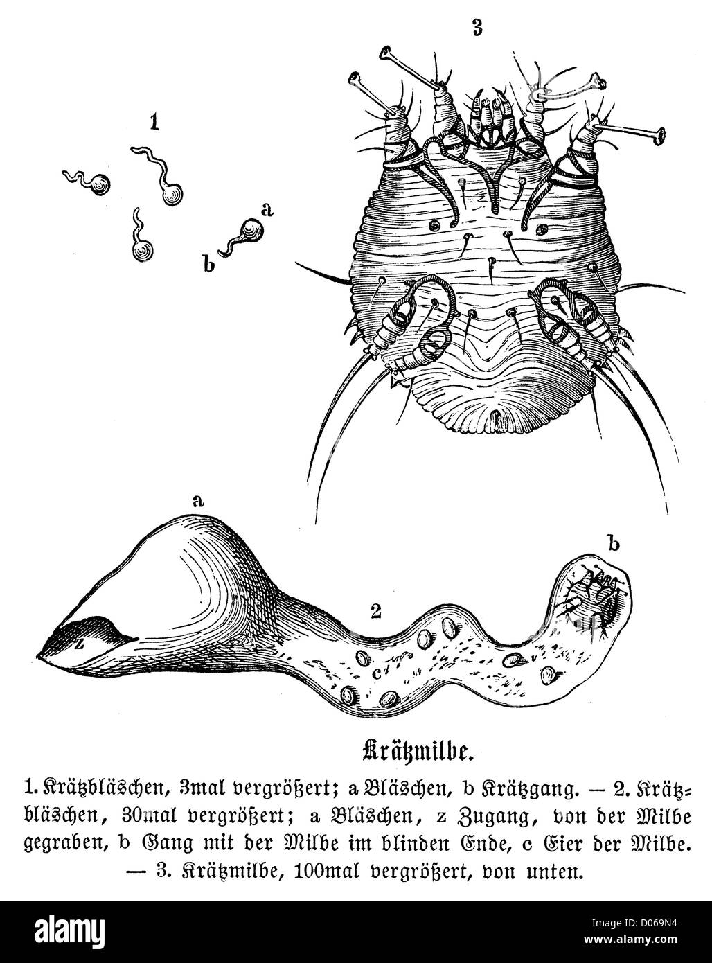 Itch drawing hi-res stock photography and images - Alamy