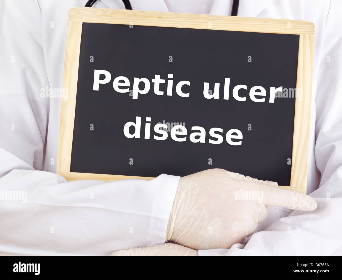 Doctor shows information: peptic ulcer disease Stock Photo - Alamy