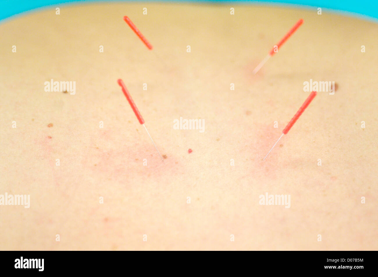No medical treatment hi-res stock photography and images - Alamy