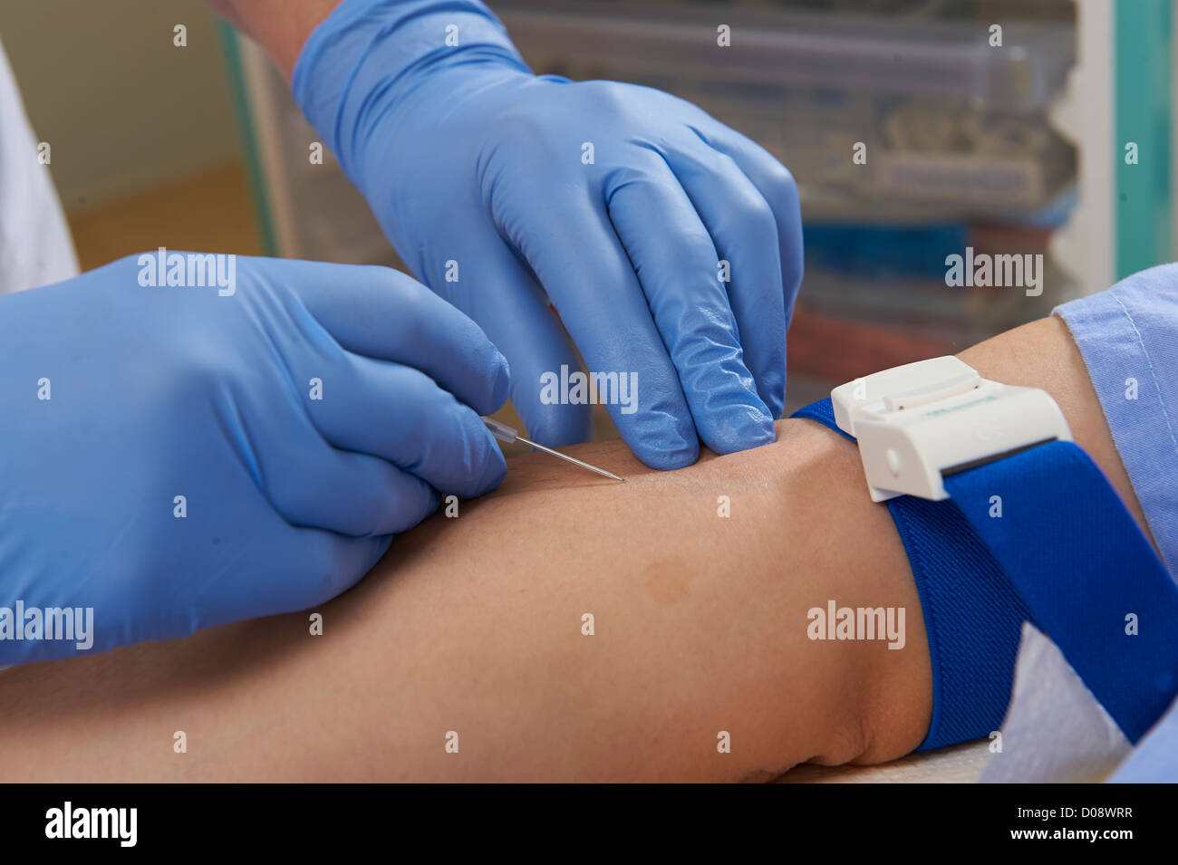 Nurse Inserting Needle For IV Cannula Into Patient's Arm, 41% OFF