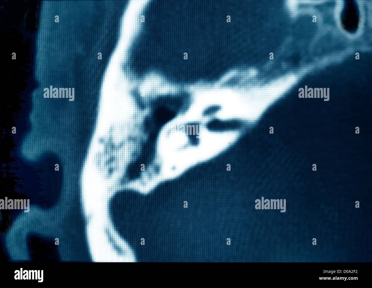 INTERNAL EAR, SCAN Stock Photo - Alamy
