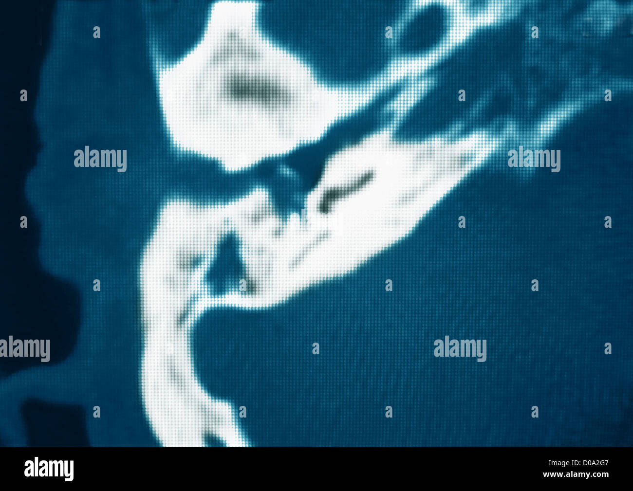 INTERNAL EAR, SCAN Stock Photo - Alamy