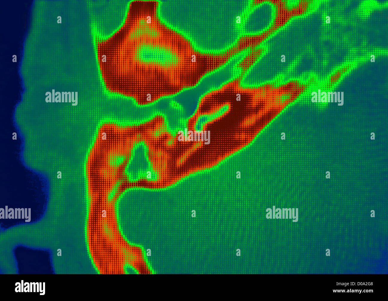 INTERNAL EAR, SCAN Stock Photo - Alamy