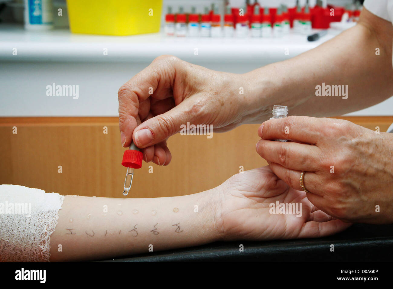 ALLERGY TEST, CHILD Stock Photo - Alamy