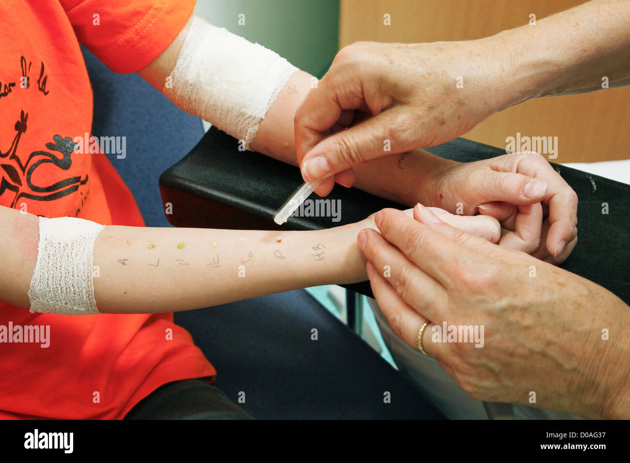 Allergy test at the arm hi-res stock photography and images - Alamy