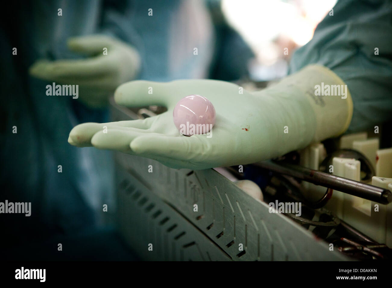 HIP PROSTHESIS, SURGERY Stock Photo - Alamy