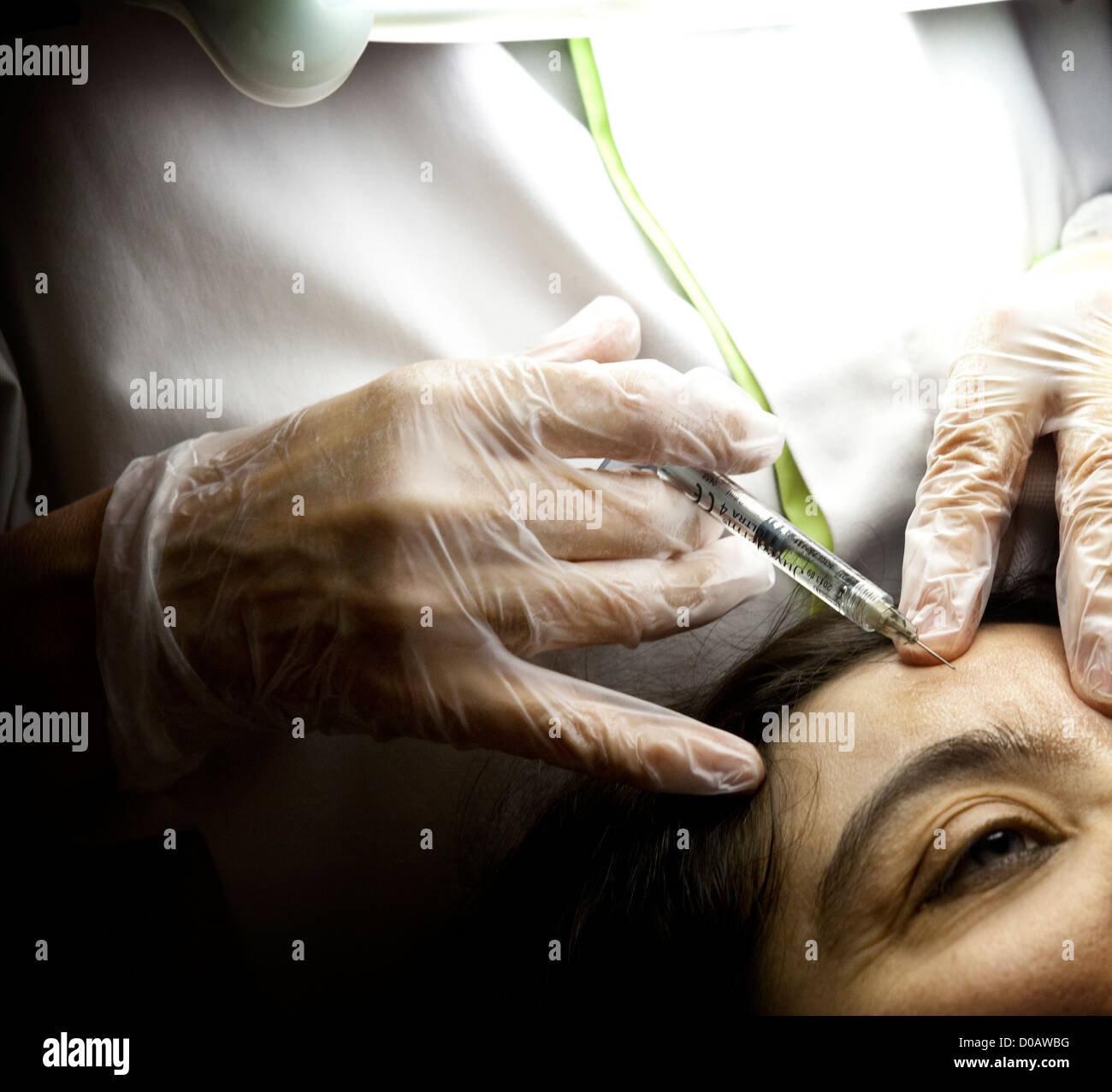 BOTOX TREATMENT, WOMAN Stock Photo - Alamy