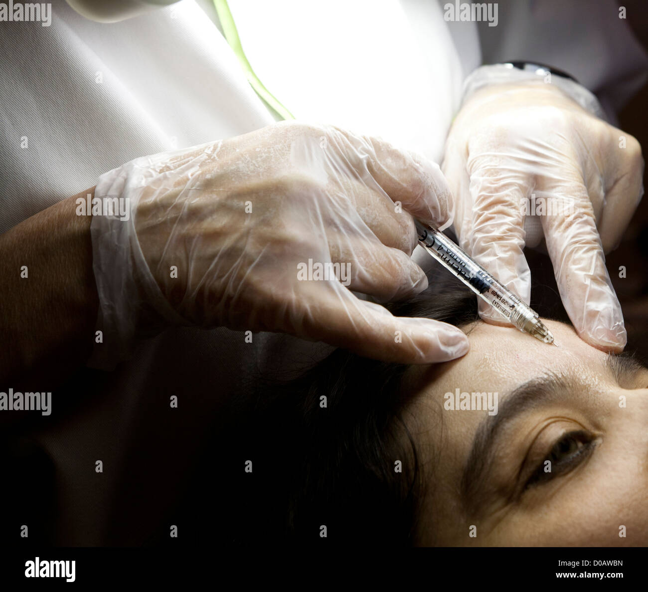 BOTOX TREATMENT, WOMAN Stock Photo - Alamy